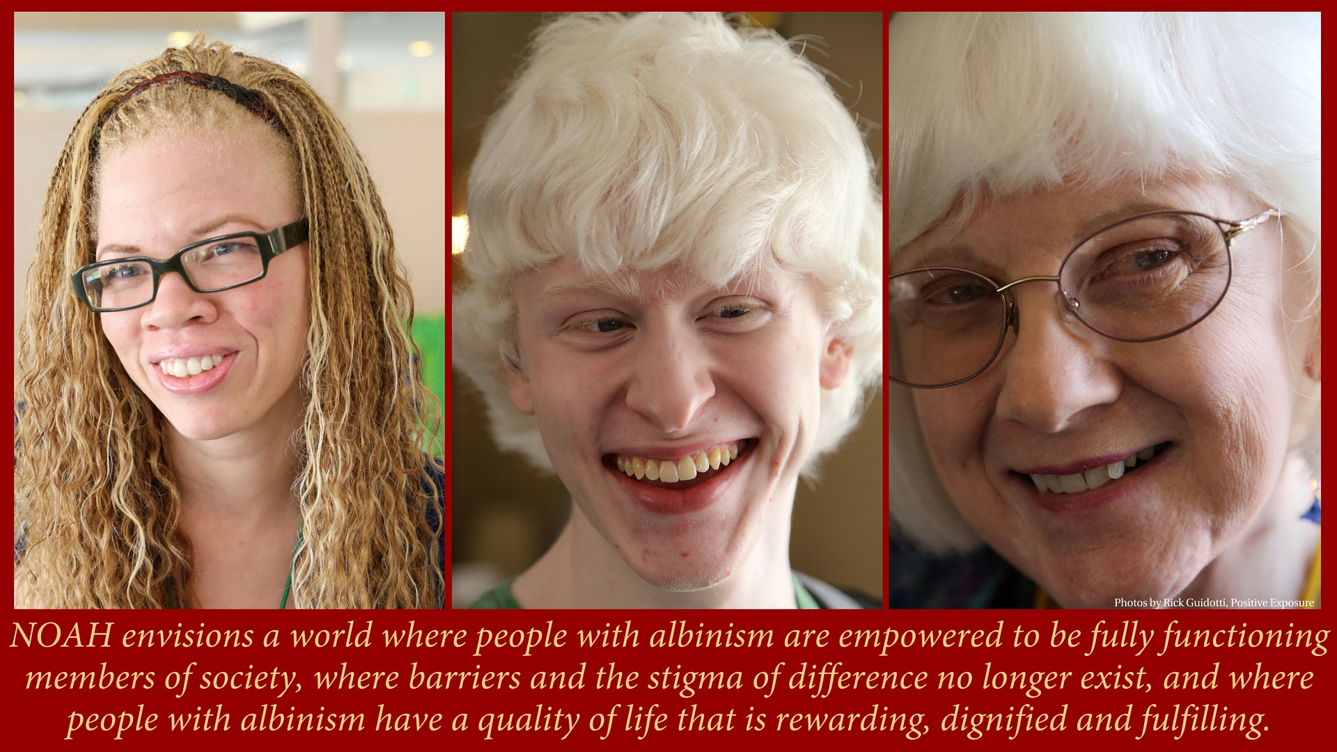 International Albinism Awareness Day - National Organization for ...