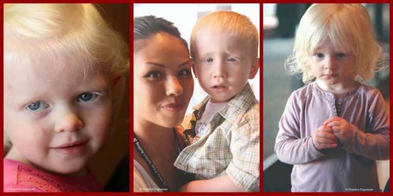 Newly Diagnosed Children – New Parent Program - National Organization ...