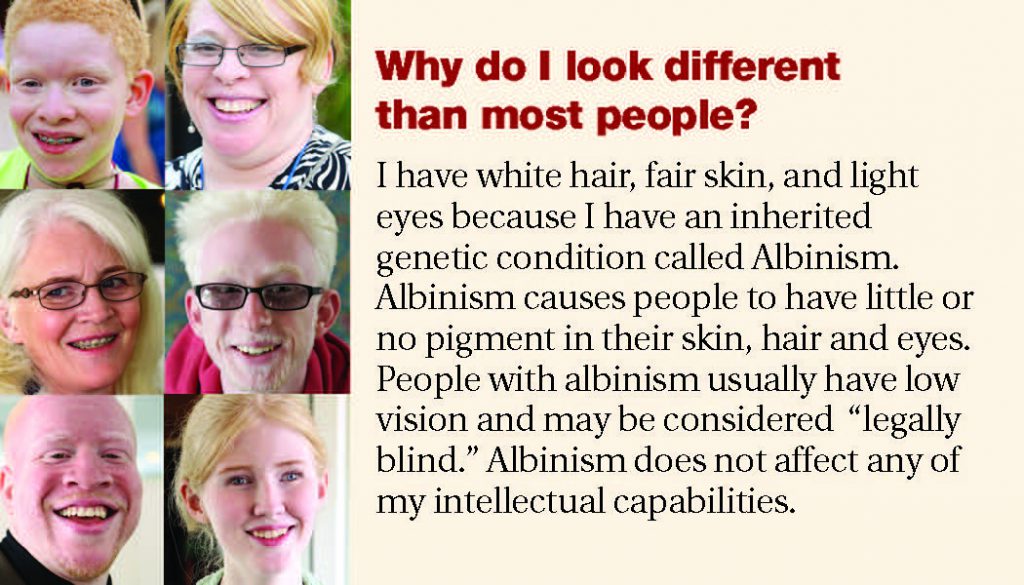 Spring Fundraiser Resources - National Organization for Albinism and ...