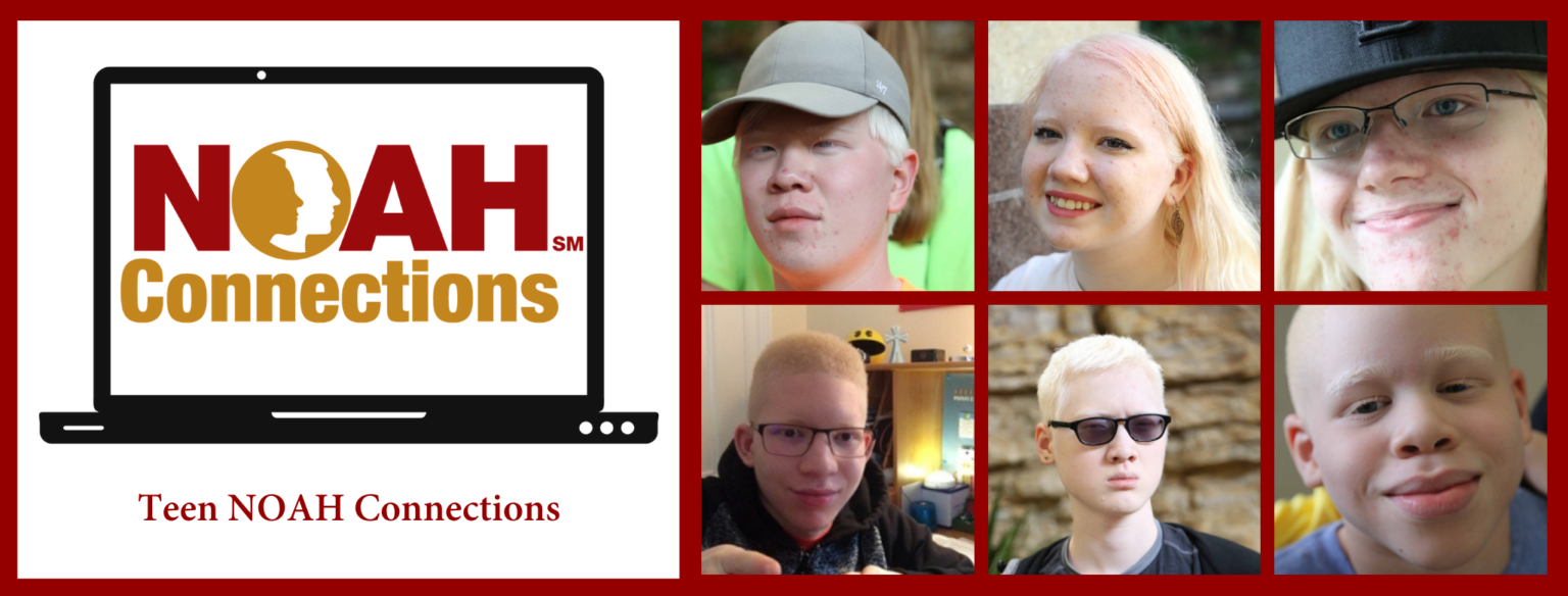 NOAH Connections - National Organization for Albinism and Hypopigmentation
