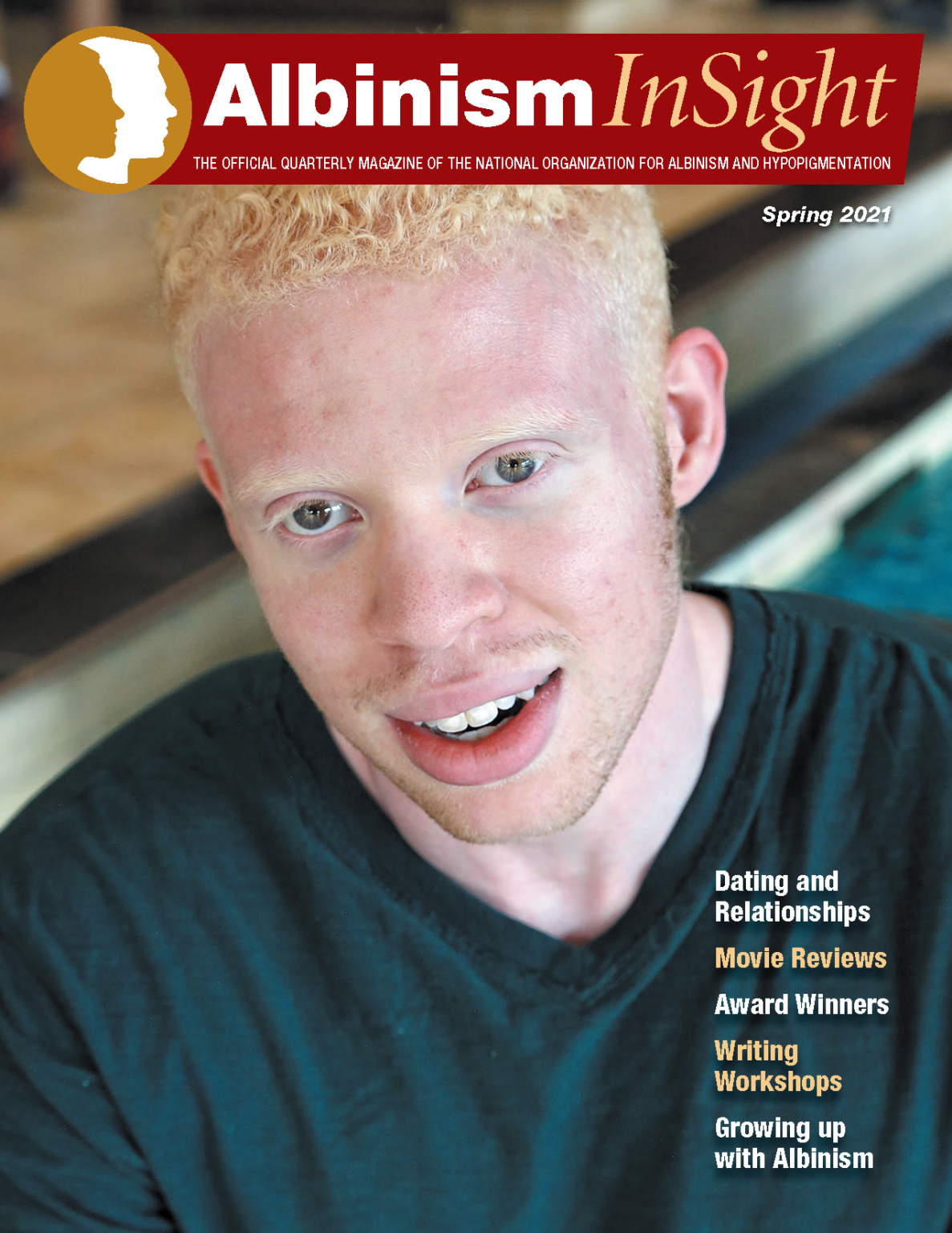 Materials - National Organization for Albinism and Hypopigmentation