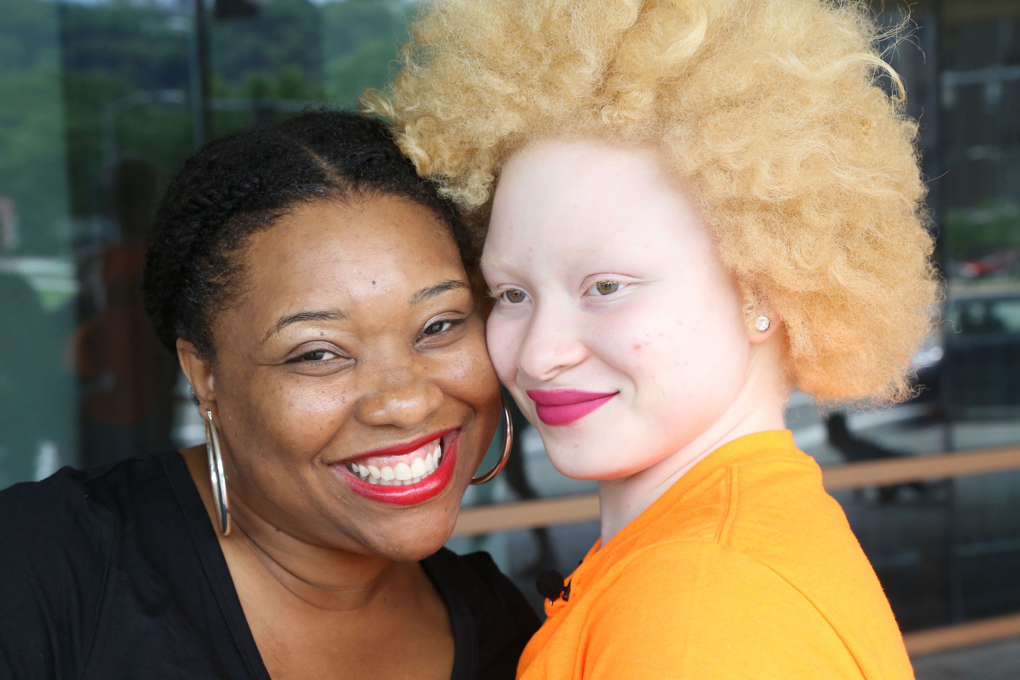 You Belong Here! - National Organization for Albinism and Hypopigmentation