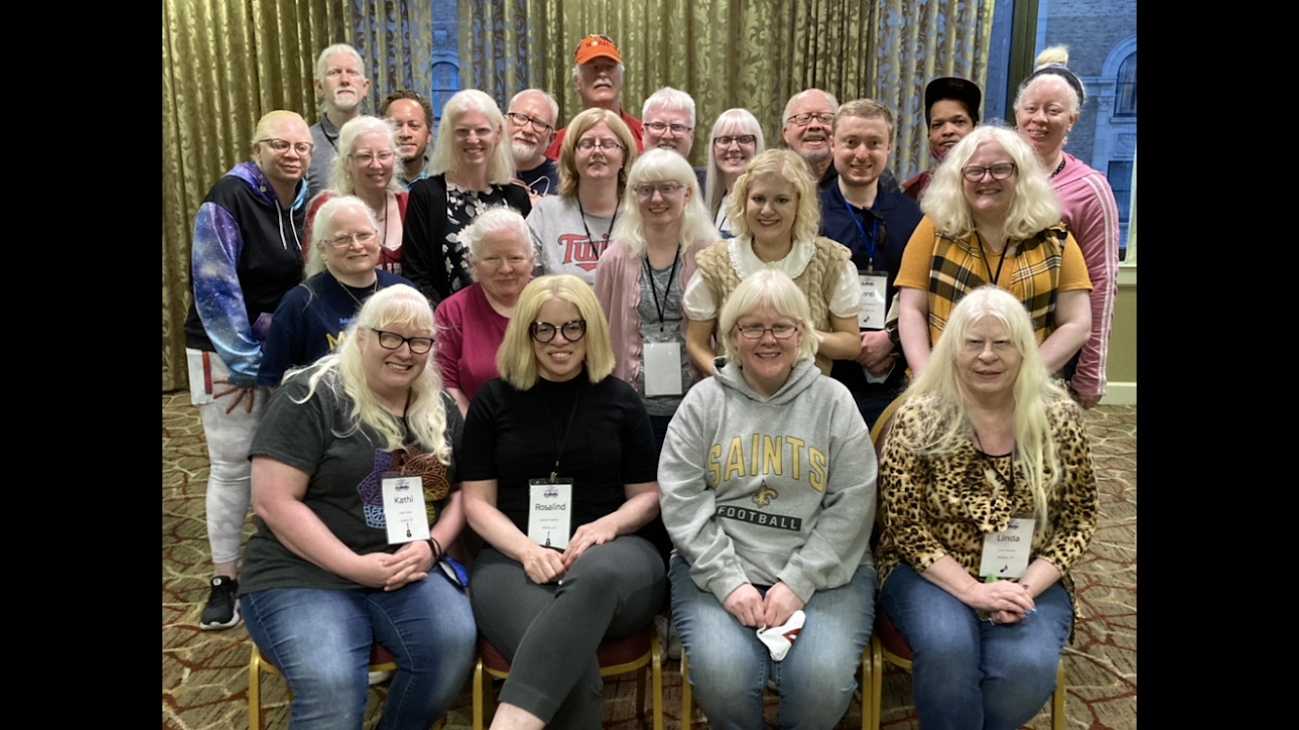 You Belong Here! - National Organization for Albinism and Hypopigmentation