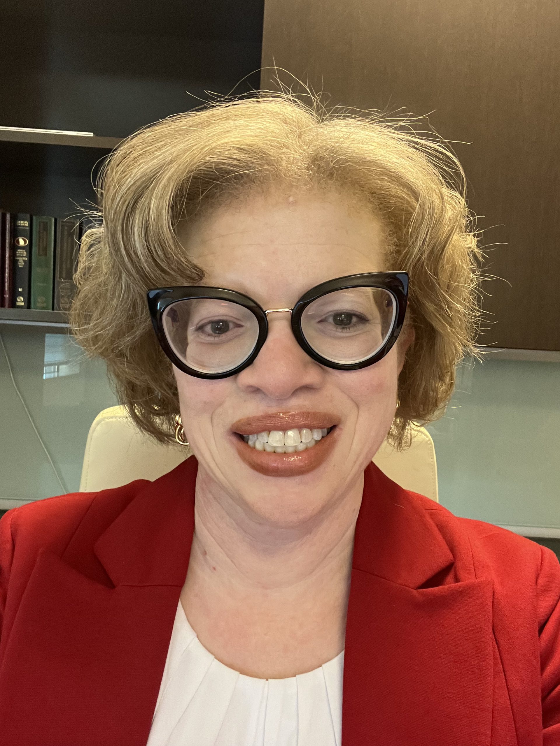 Rosalind Isom - National Organization for Albinism and Hypopigmentation