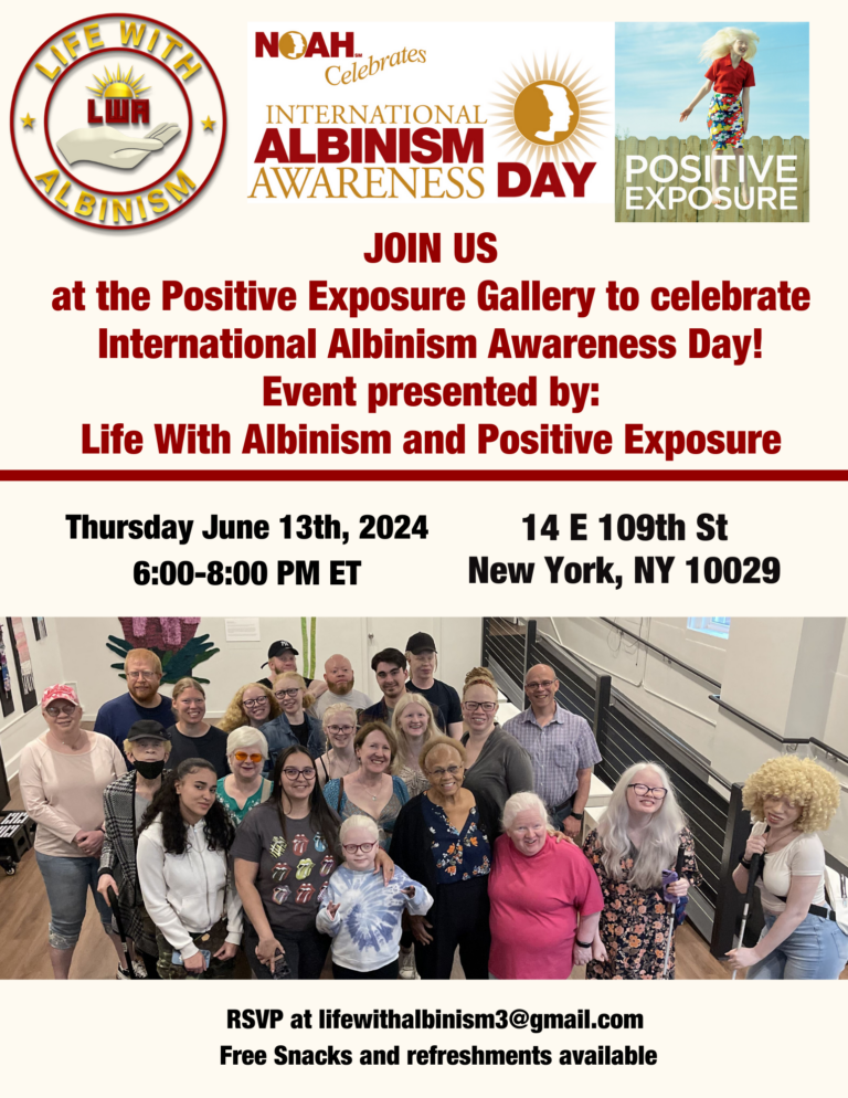 International Albinism Awareness Day - National Organization for ...
